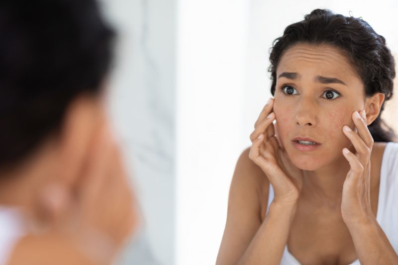 8 Tips Memperbaiki Skin Barrier yang Rusak - Blog KlikIndomaret