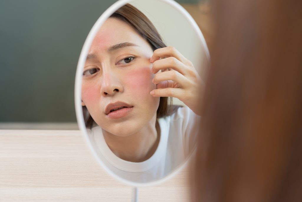6 Penyebab Skin Barrier Rusak - Blog KlikIndomaret